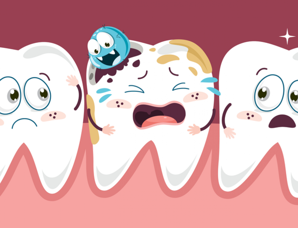 Pericoronitis: Causes, Signs, and Treatment | Pickett Family Dental