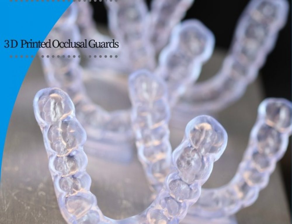 Have a Sprained Tooth? Sprained Tooth Syndrome in Keller TX