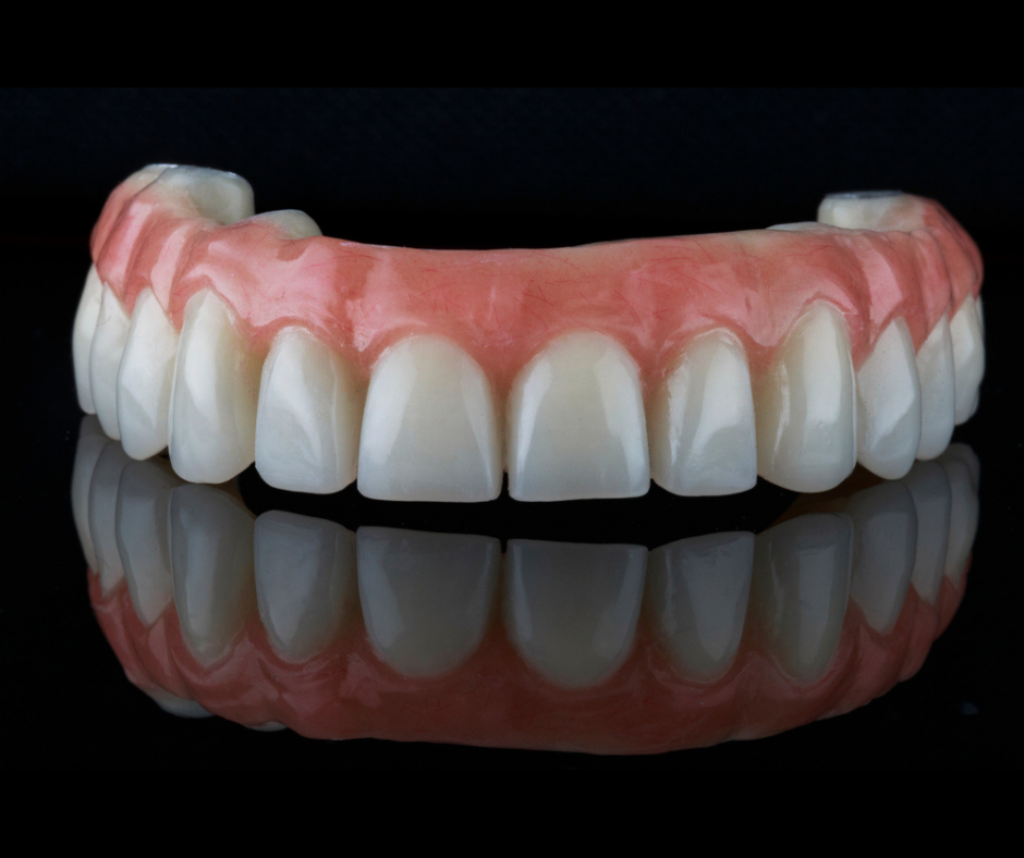 What Are Permanent Dentures Pickett Family Dental