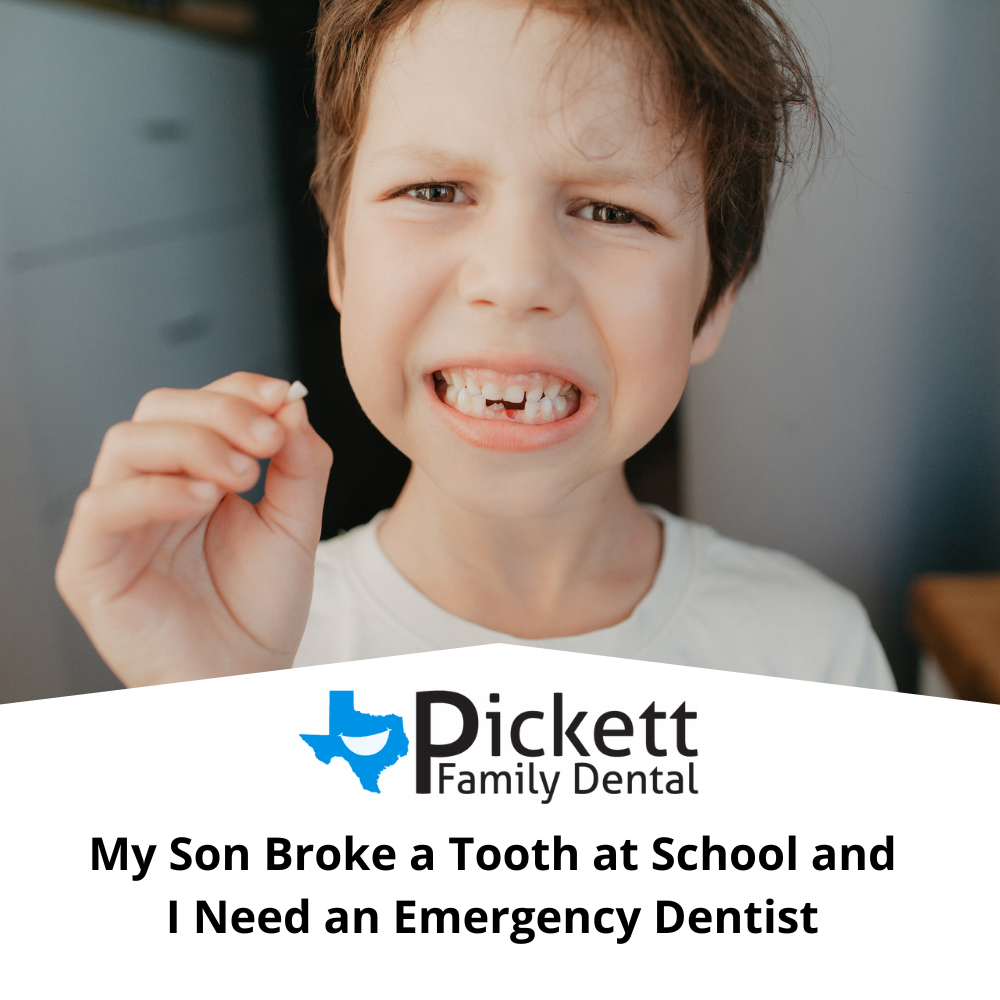 My Son Broke a Tooth at School and I Need an Emergency Dentist ...