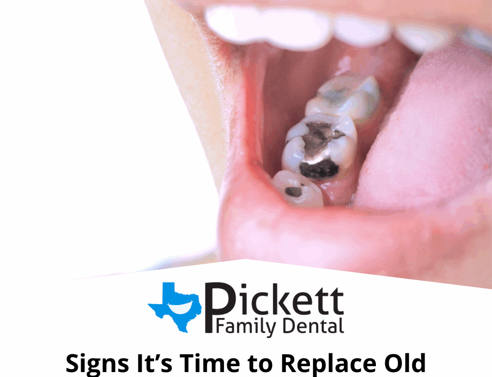 What to Expect While Wearing Temporary Veneers - Pickett Family Dental